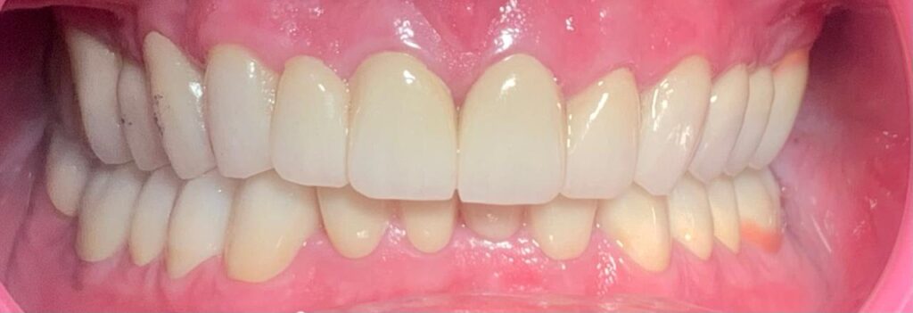 Dental Occlusion and TMJ: The Interrelationship – Fundamental Concepts, Finer Details, and ...